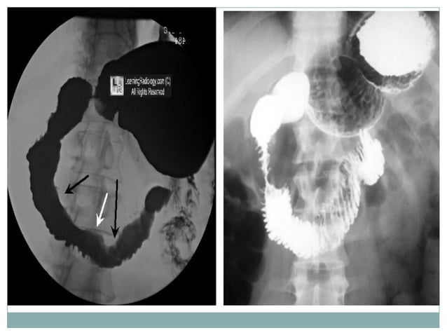 Radiology signs and symptoms | PPT