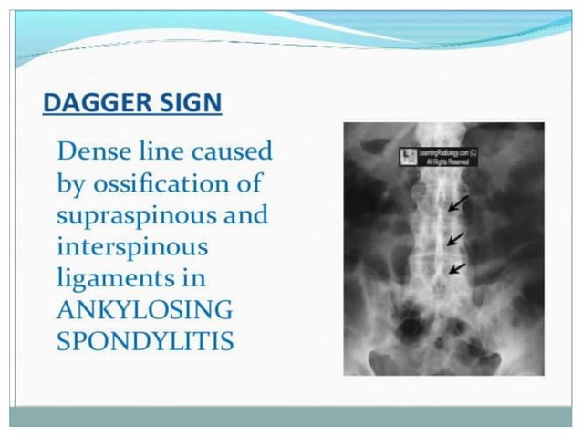 Radiology signs and symptoms | PPT