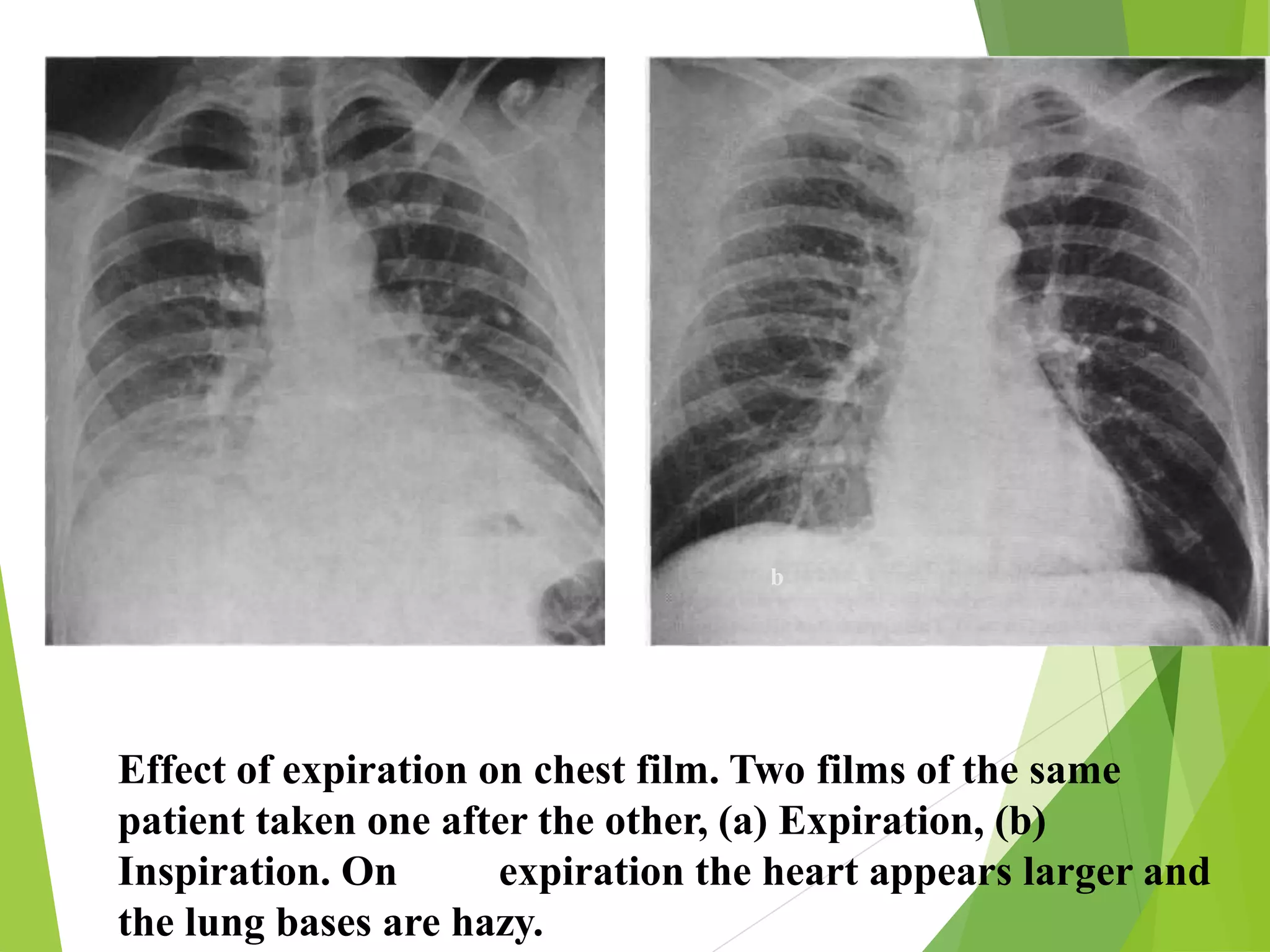 Complex clinical imaging of radiological system | PPT