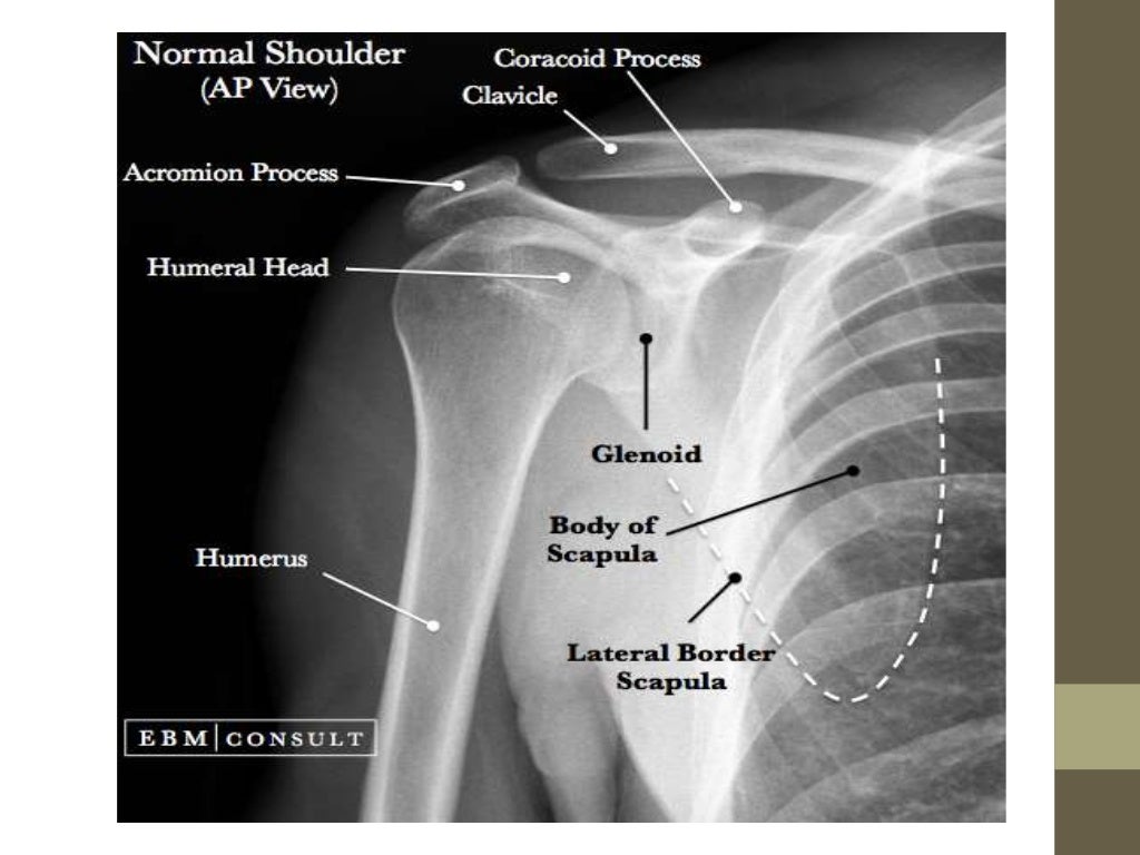 RADIOLOGY. - Pectoral region and upper limb pptx.pptx