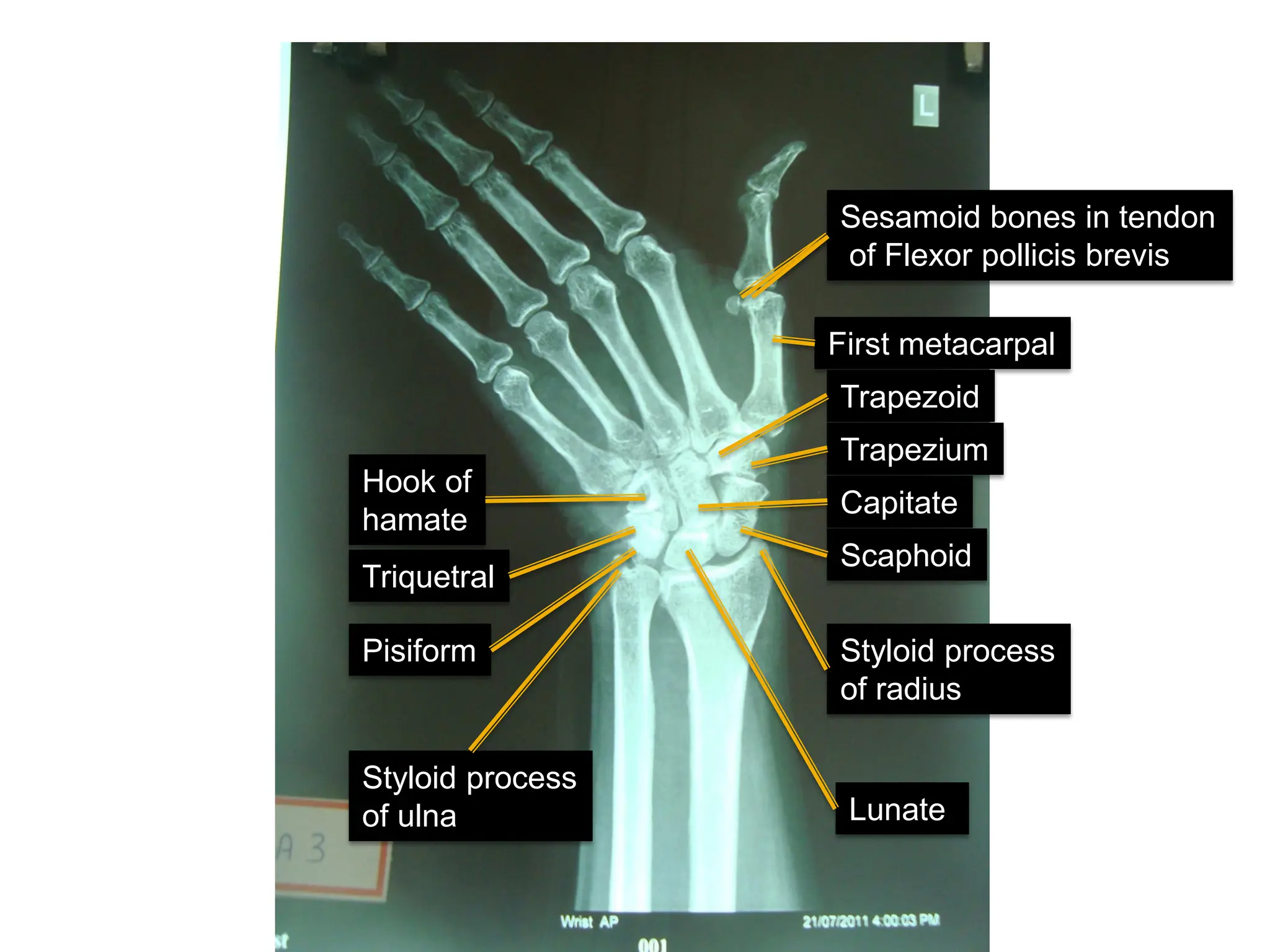 Radiology and details about x-ray and its pictures | PDF