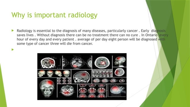 Search June 20, 2019 Fun facts about radiology | PPT