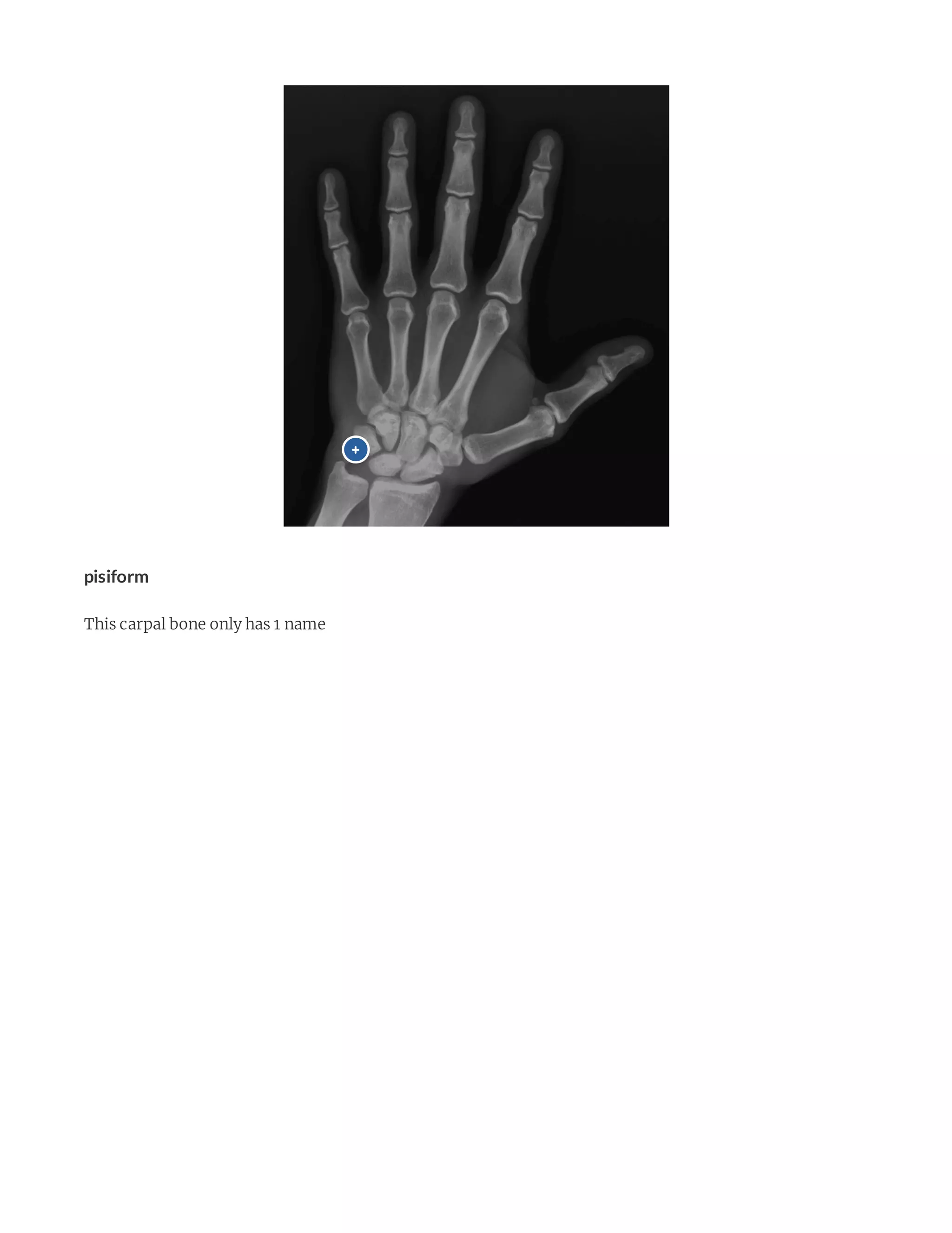 Radiology Anatomy of the Hand and Wrist | PDF