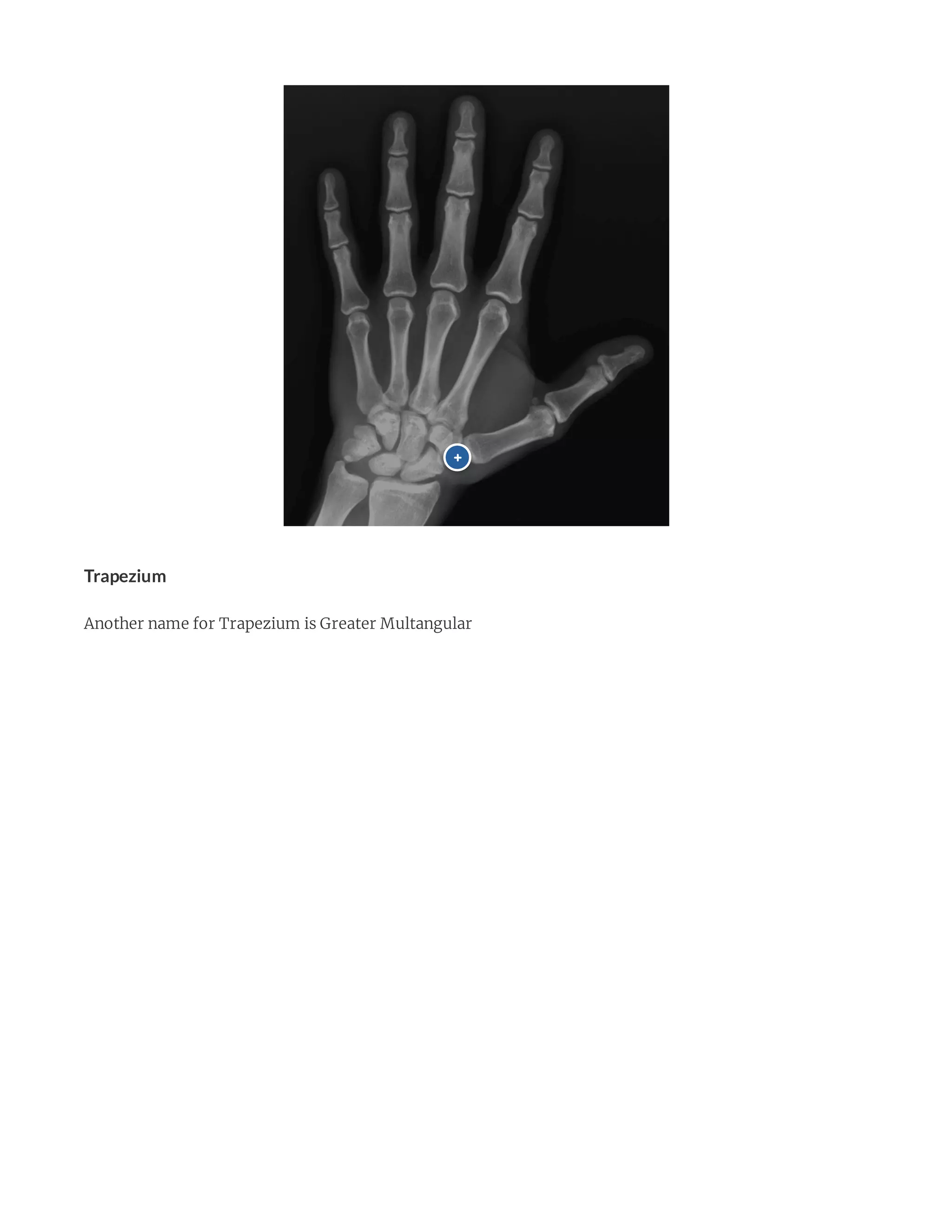 Radiology Anatomy of the Hand and Wrist | PDF