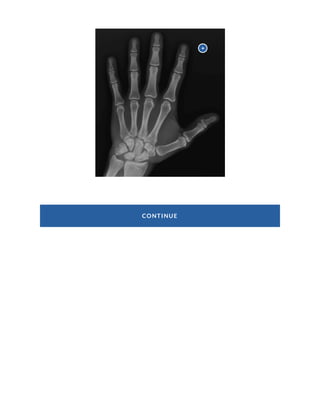 Radiology Anatomy of the Hand and Wrist | PDF