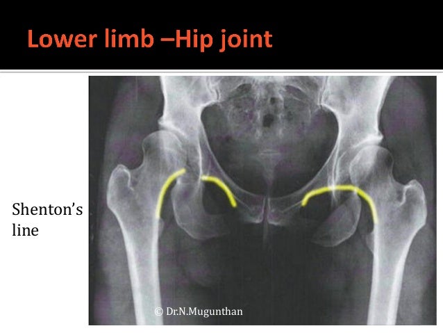 Radiology -Dr.N.Mugunthan