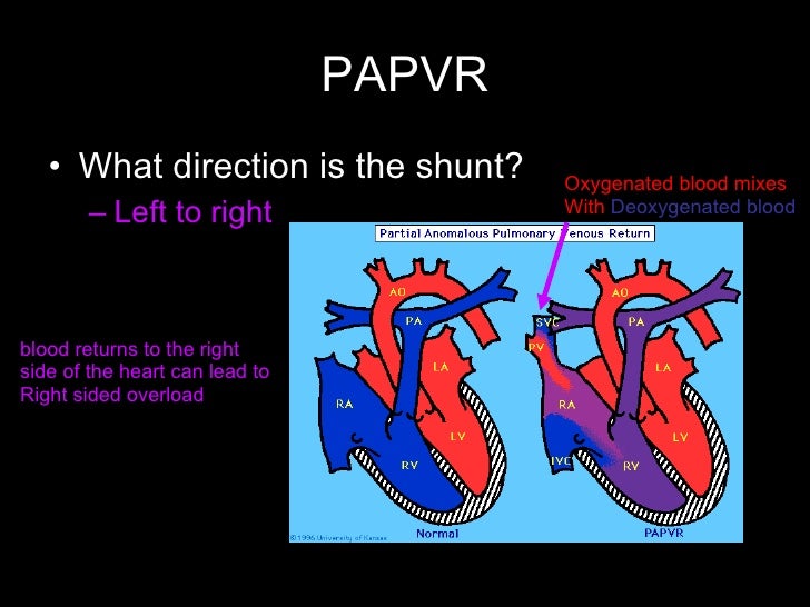 Radiology Rounds 71 Year Old Female,
