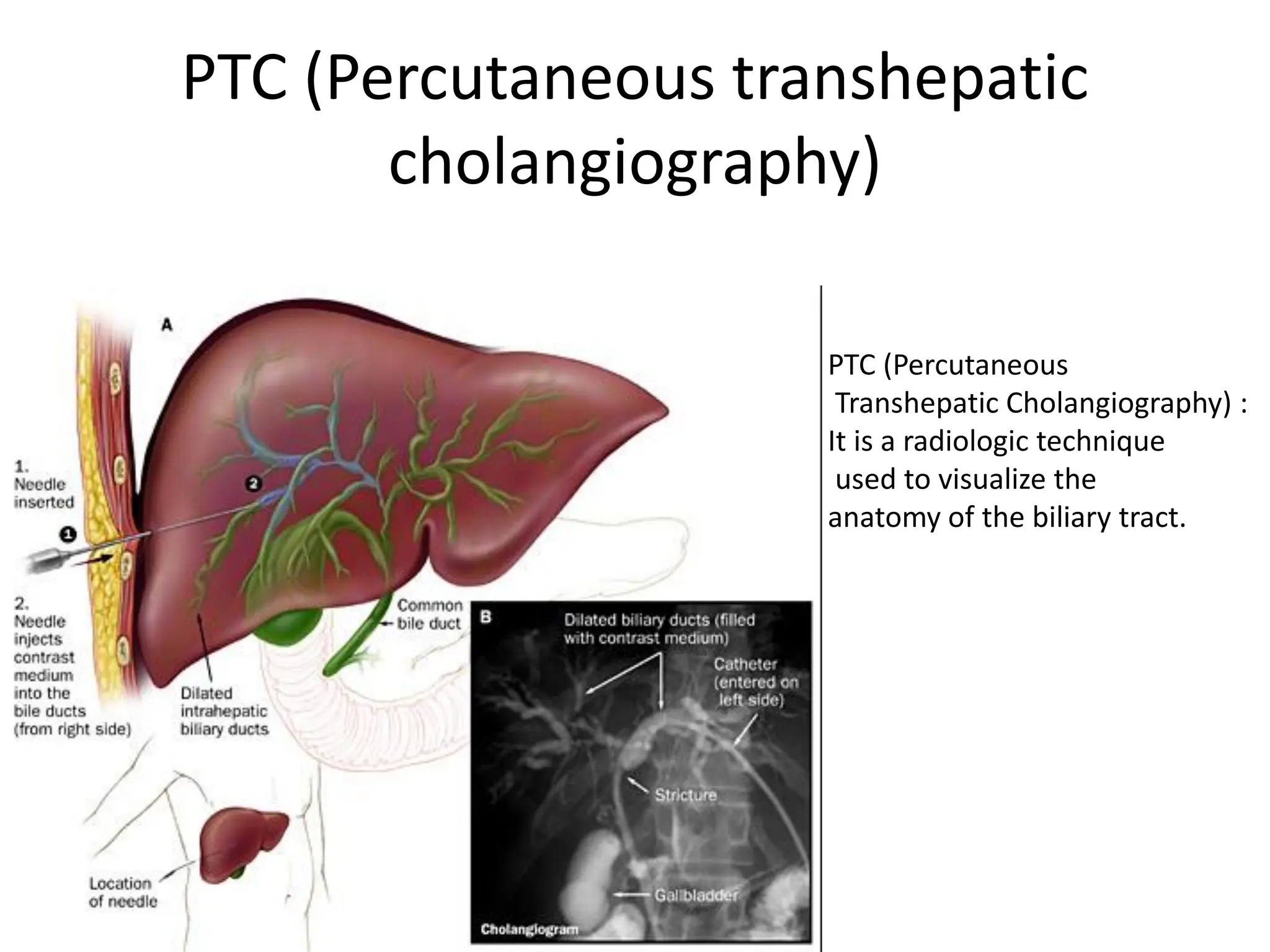 RADIOLOGY -SURGERY-.pdf. Hgef vvvvcc ghar | PPT