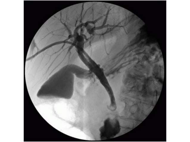 RADIOLOGY -SURGERY-.pdf. Hgef vvvvcc ghar | PPT