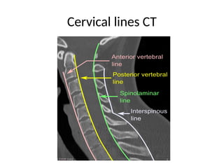 radiology 1.pptx cervical and lumbar x ray | PPTX