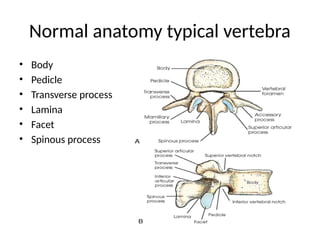 radiology 1.pptx cervical and lumbar x ray | PPTX