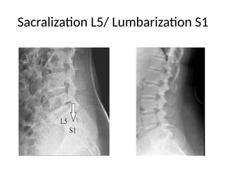 radiology 1.pptx cervical and lumbar x ray | PPTX