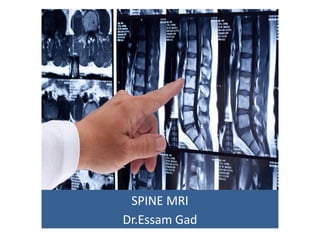 radiology MRI cervical and lumbar spine.pptx