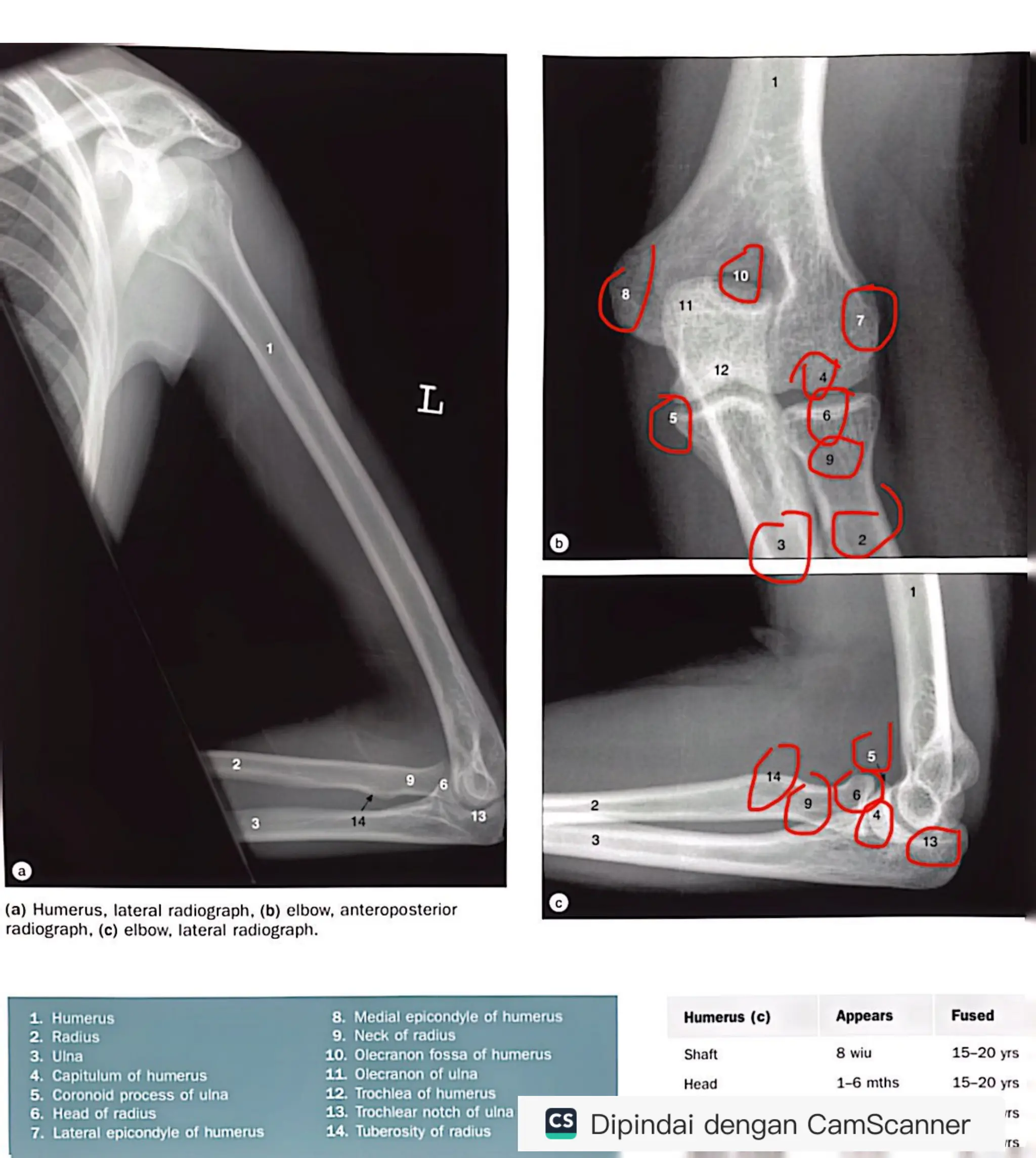 RADIOLOGY ANATOMY JUNIOR.pdf