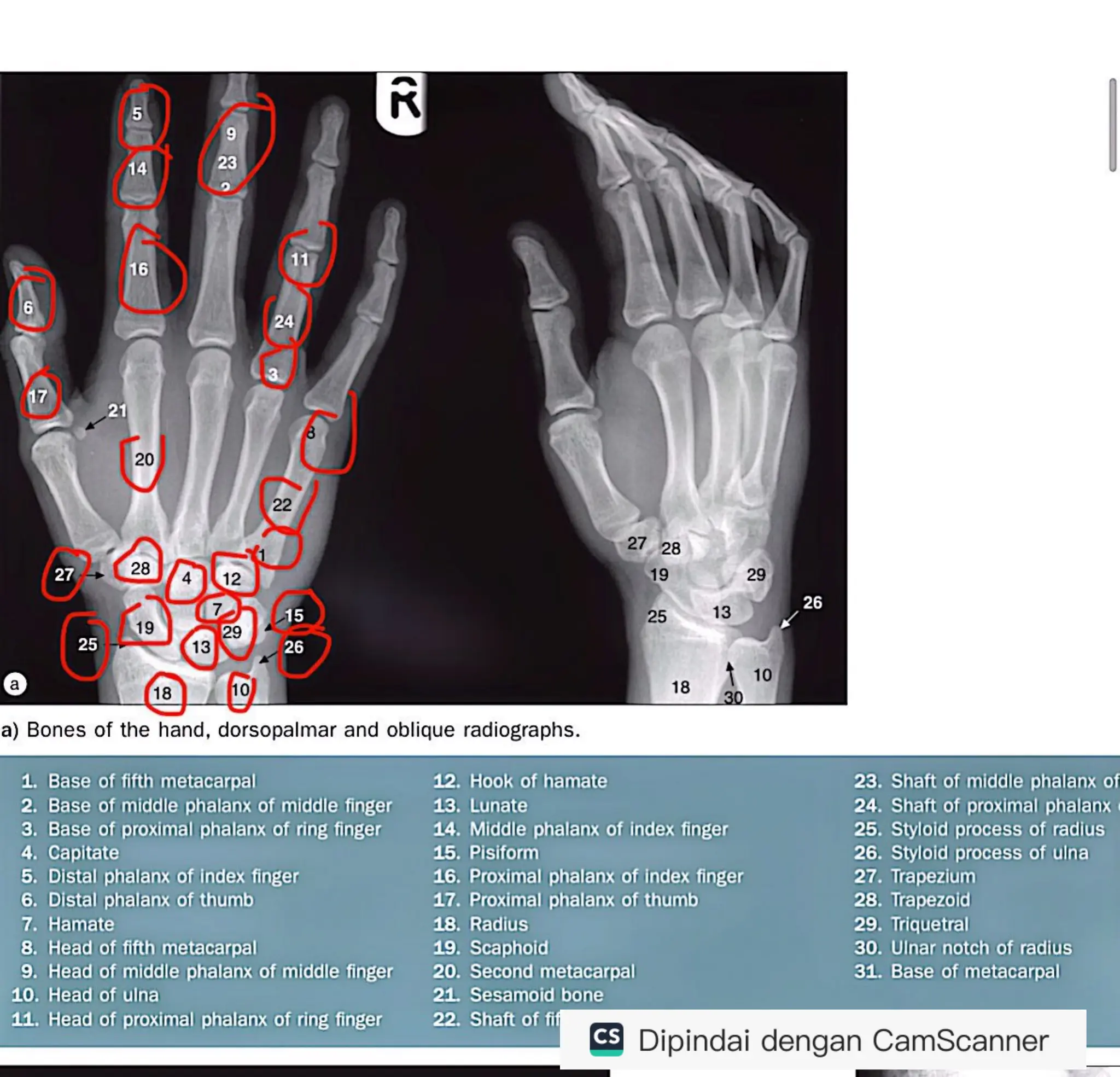 RADIOLOGY ANATOMY JUNIOR.pdf