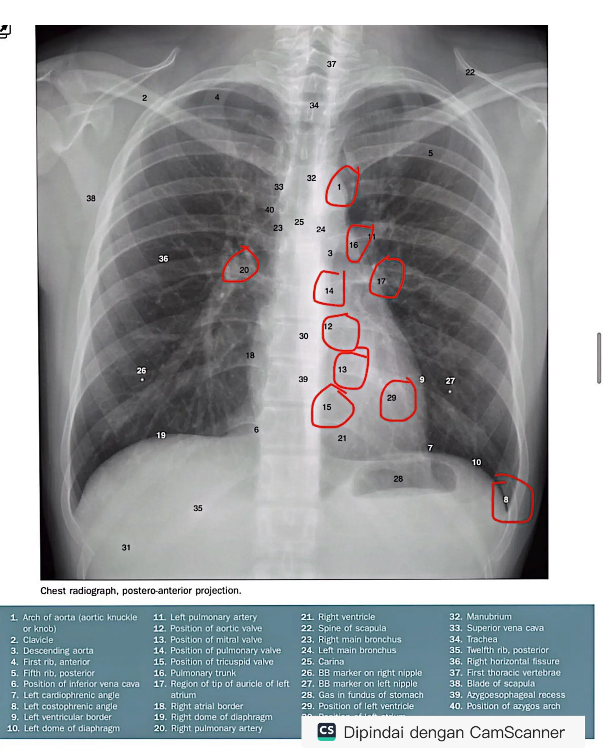 RADIOLOGY ANATOMY JUNIOR.pdf