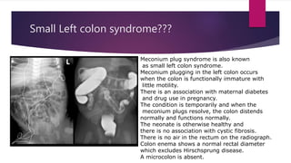 Radiology and contrast studies in newborns [autosaved] | PPT
