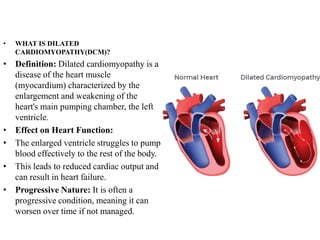 RADIOLOGY AND IMAGING for dilated cardiomyopatht | PDF
