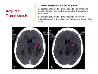 RADIOLOGY and US Imaging for Protozoal Diseases.pptx