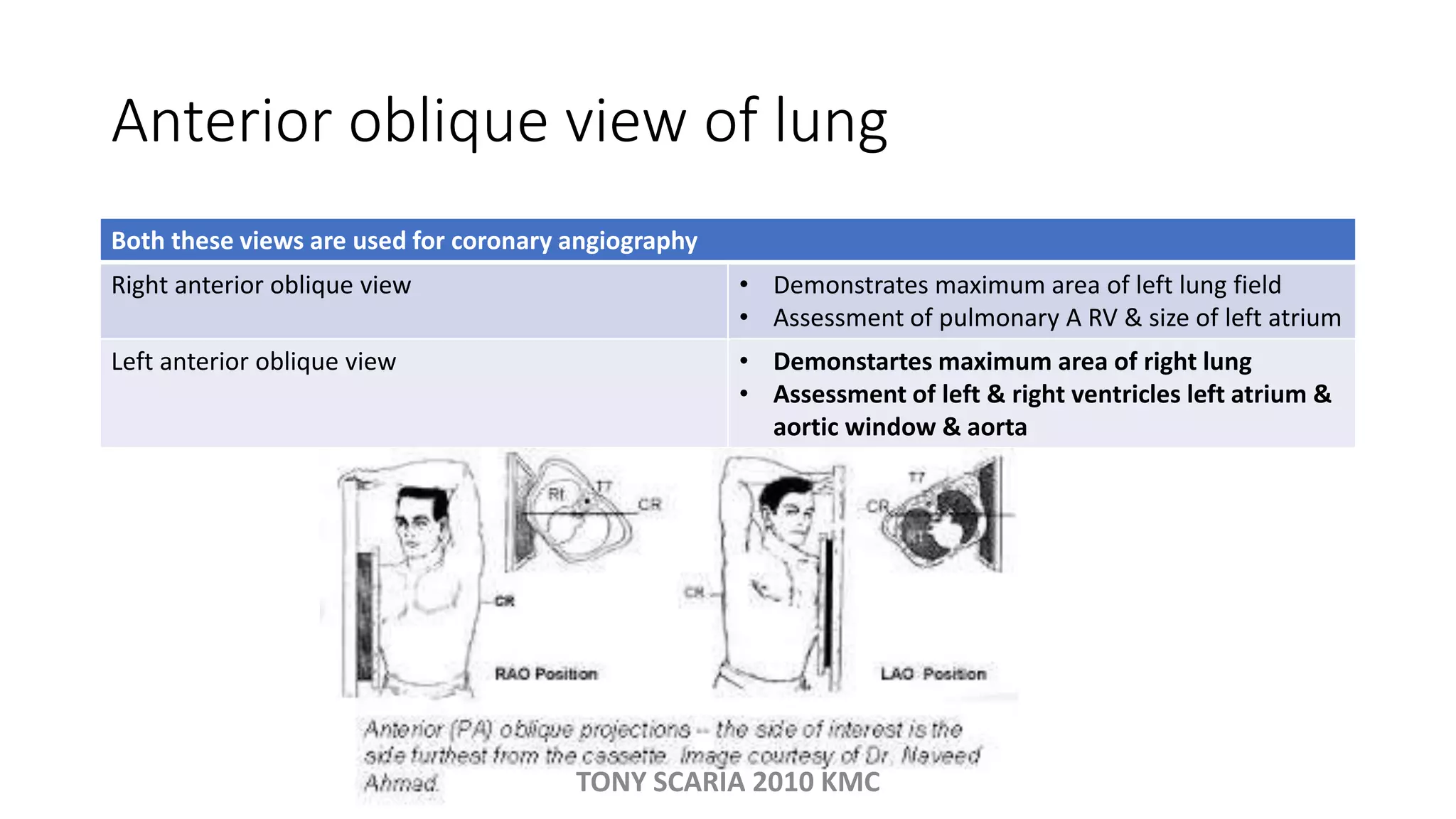 RESPIRATORY SYSTEM REVISION NOTES | PPT