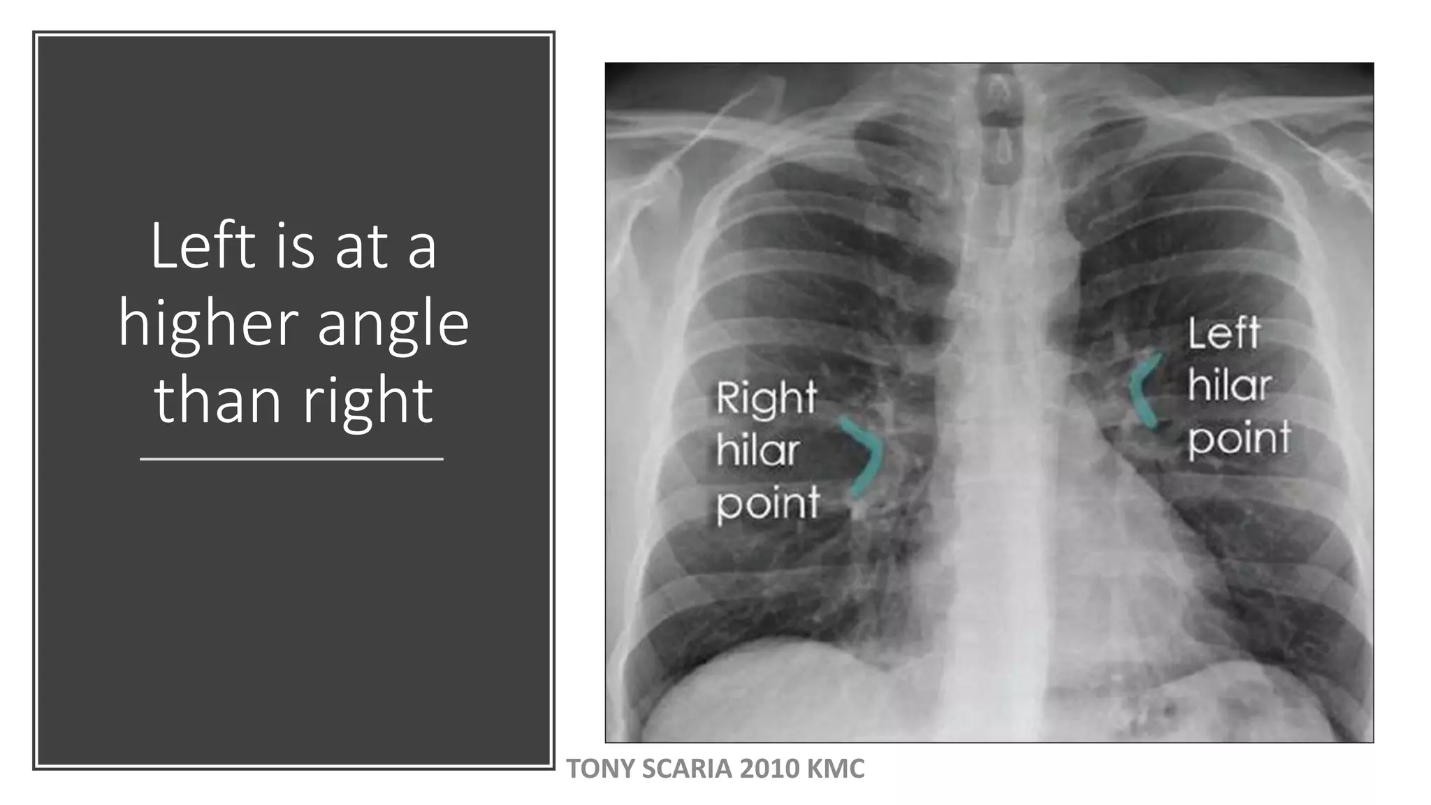 RESPIRATORY SYSTEM REVISION NOTES | PPT