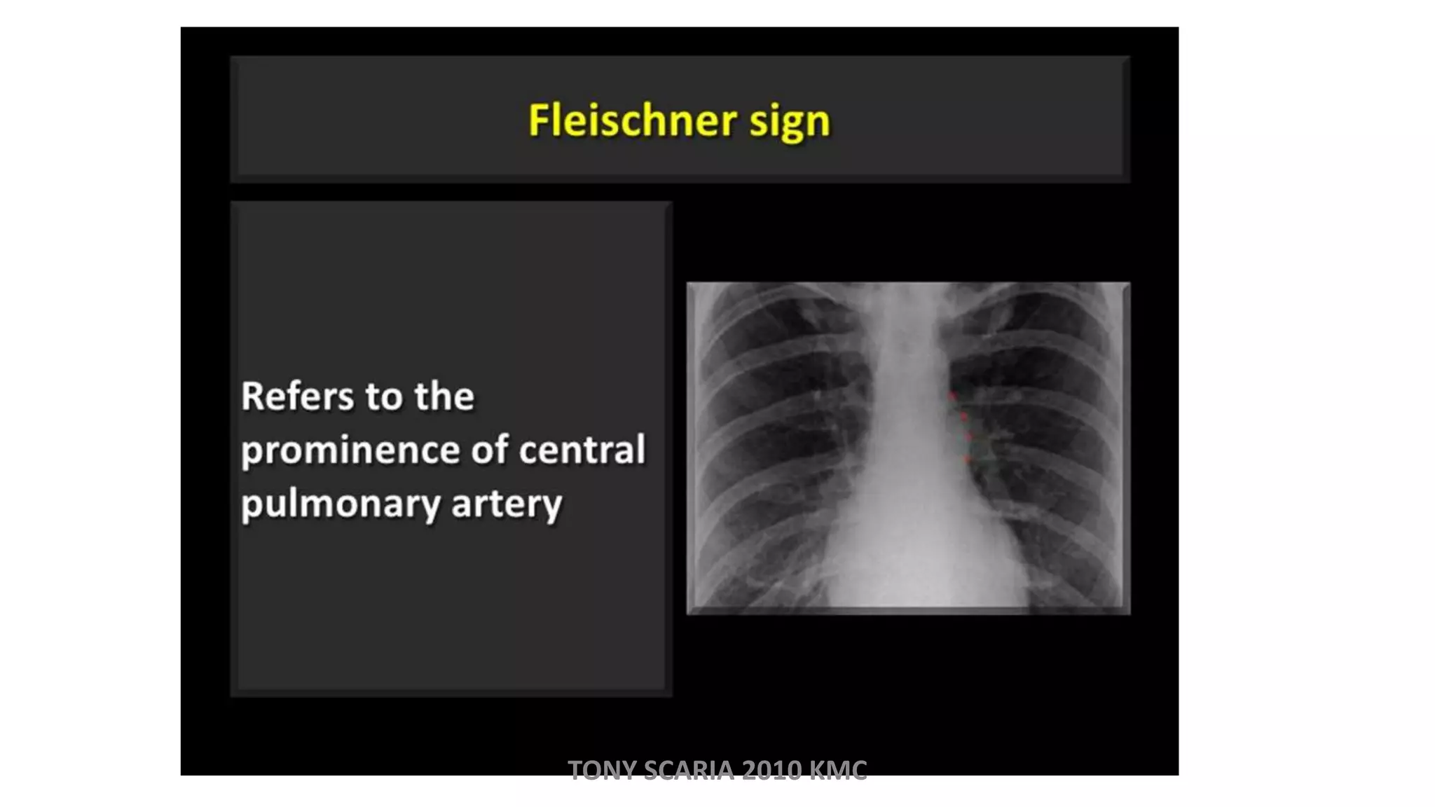 RESPIRATORY SYSTEM REVISION NOTES | PPT