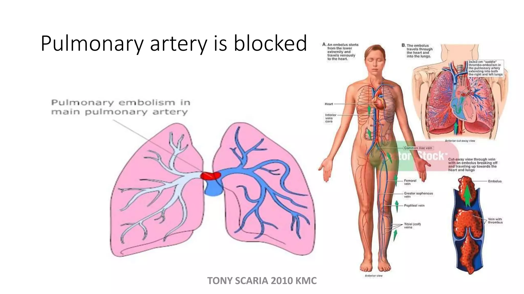 RESPIRATORY SYSTEM REVISION NOTES | PPT