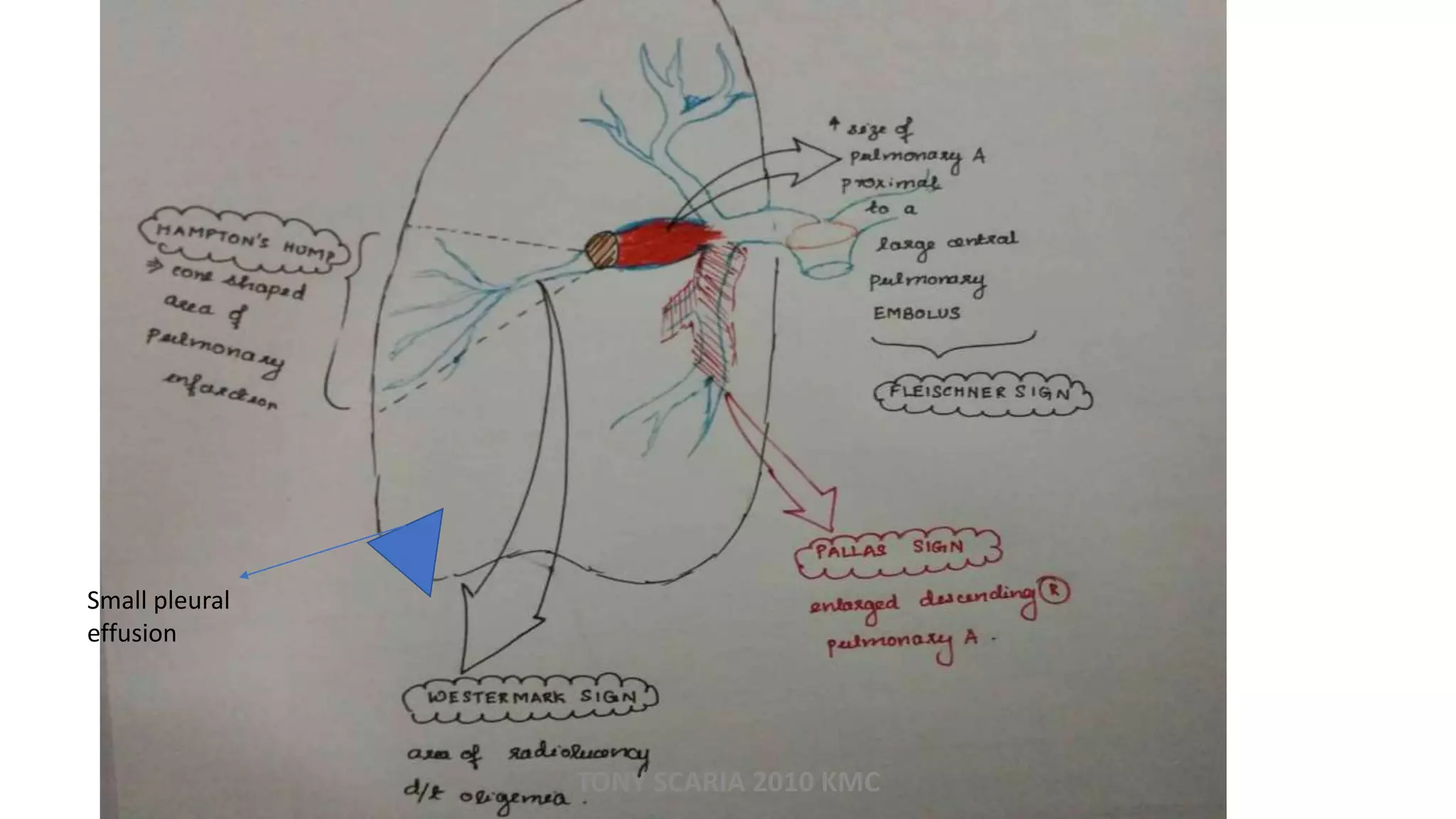 RESPIRATORY SYSTEM REVISION NOTES | PPT