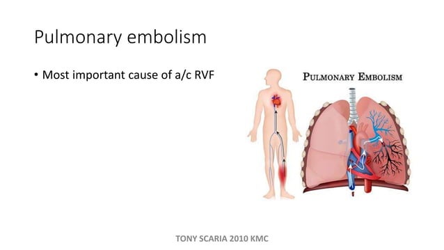 RESPIRATORY SYSTEM REVISION NOTES | PPT