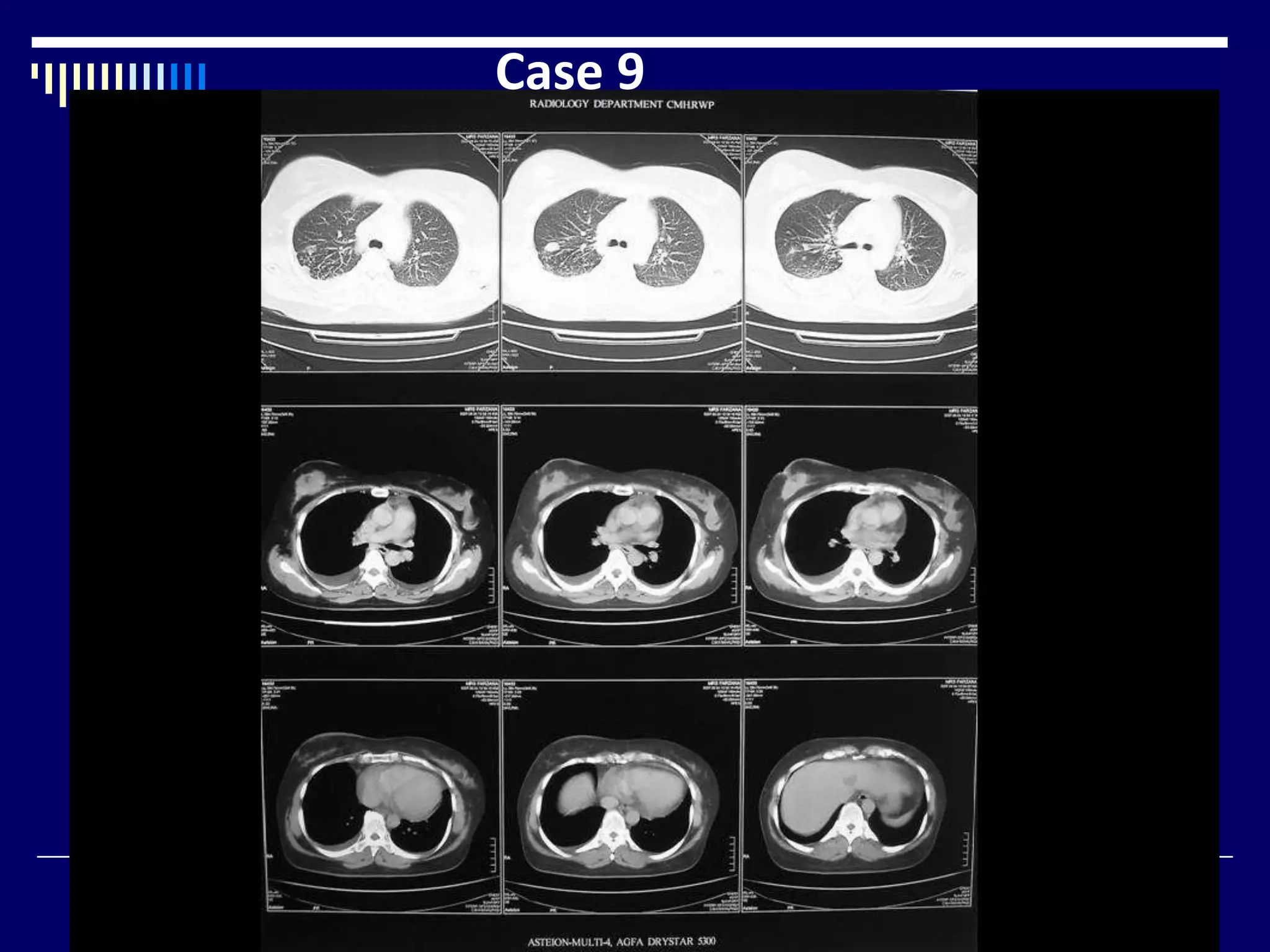 Radiology chest assessment | PPTX