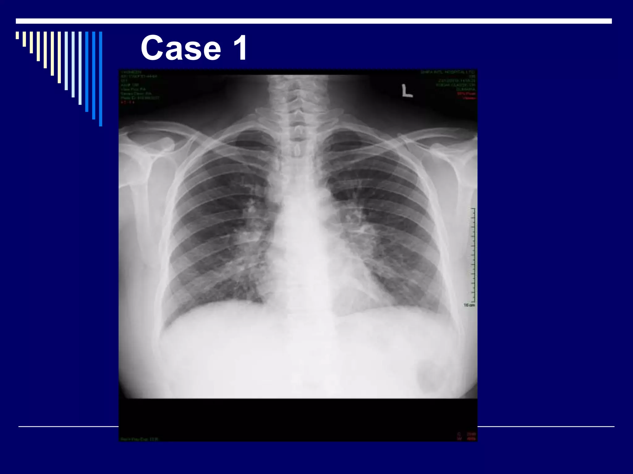 Radiology chest assessment | PPTX