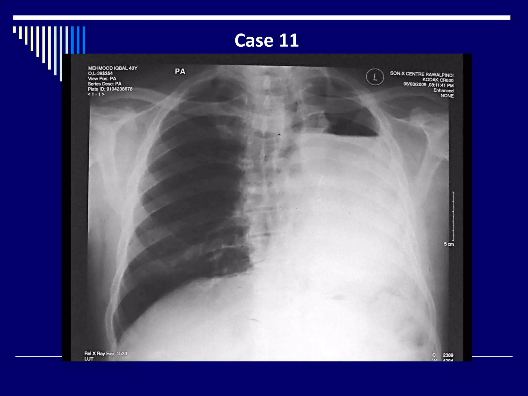 Radiology chest assessment | PPTX