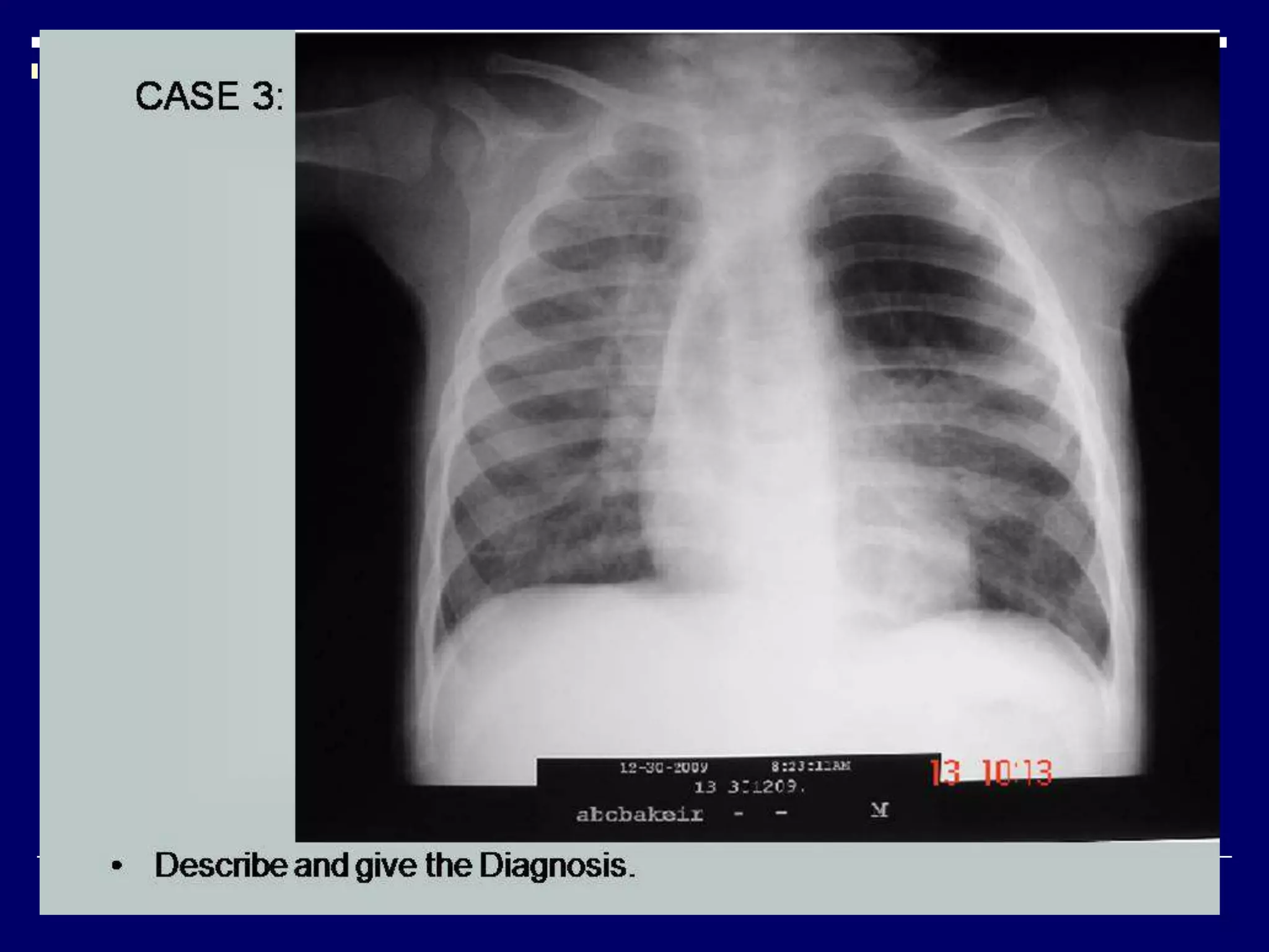 Radiology chest assessment | PPTX