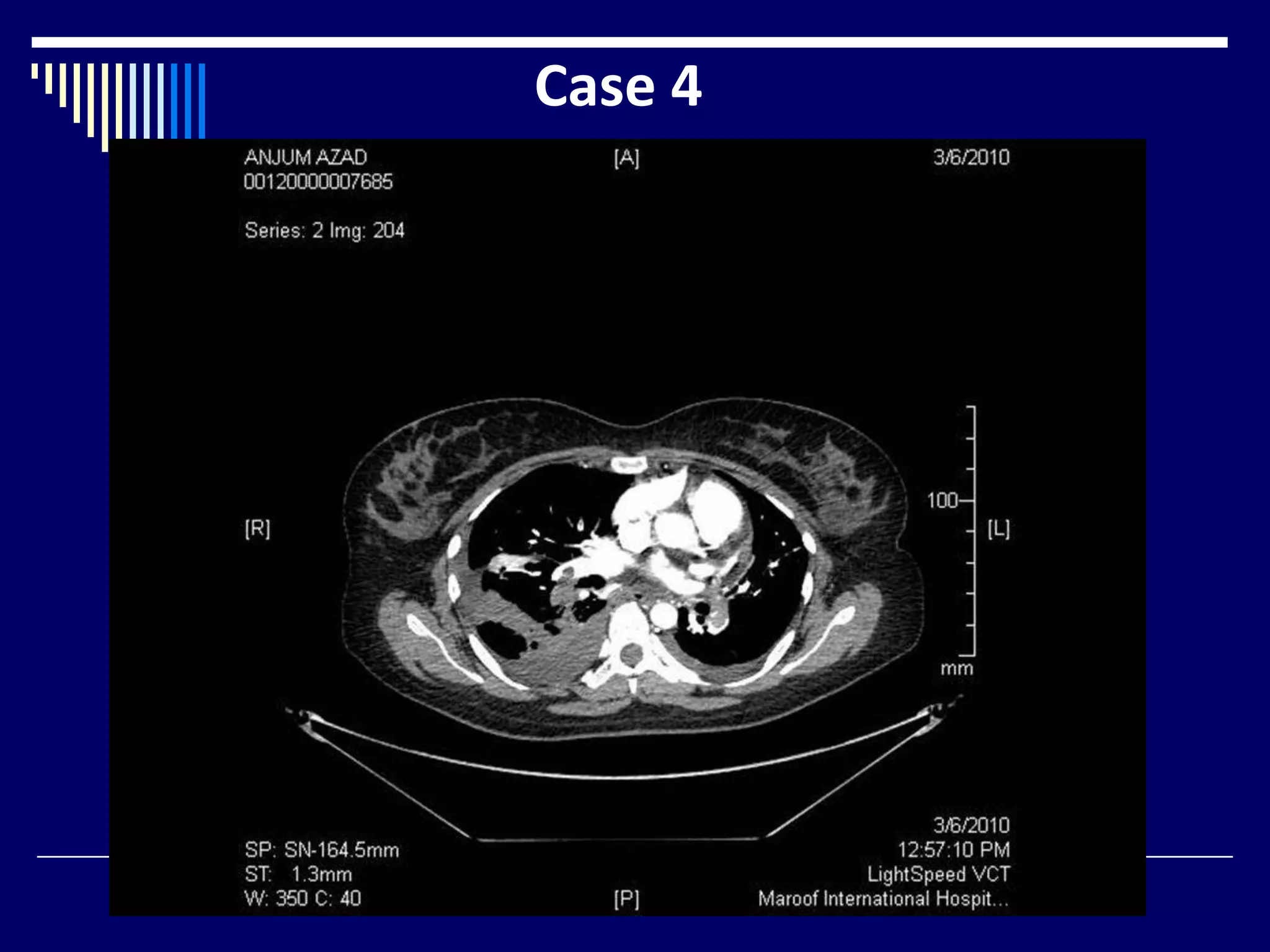 Radiology chest assessment | PPTX | Lung and Respiratory Health ...