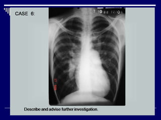 Radiology chest assessment | PPTX | Lung and Respiratory Health ...