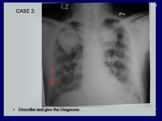 Radiology chest assessment | PPTX | Lung and Respiratory Health ...