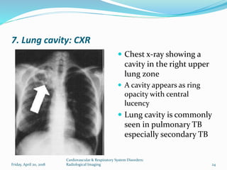 Radiology chs 3101 cardiovascular and respiratory system disorders | PPTX