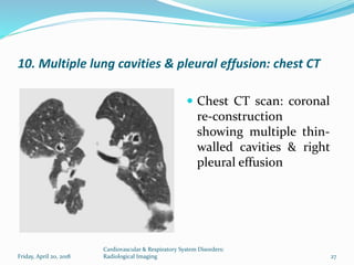 Radiology chs 3101 cardiovascular and respiratory system disorders | PPTX
