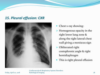 Radiology chs 3101 cardiovascular and respiratory system disorders | PPTX