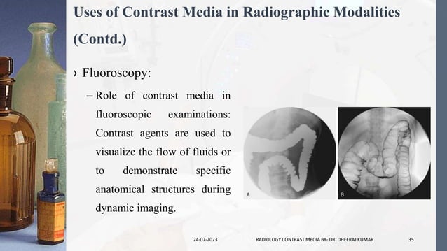 Radiology Contrast Media.pptx | Digestive Disorders | Diseases and ...