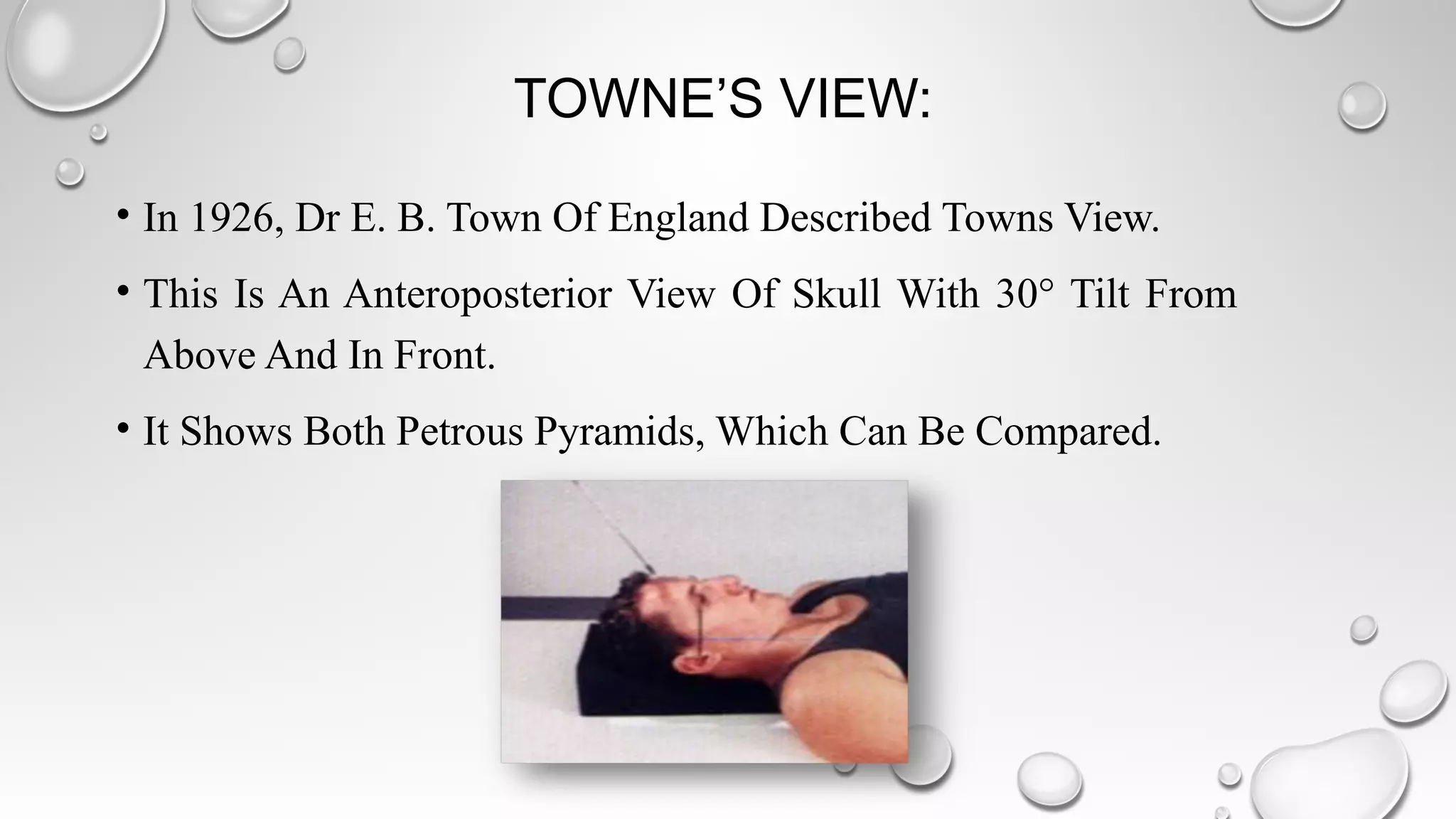 Radiological Imaging in Head and Neck and relevant anatomy | PPT