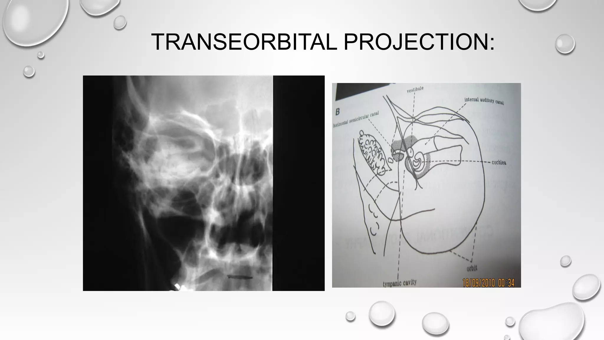 Radiological Imaging in Head and Neck and relevant anatomy | PPT