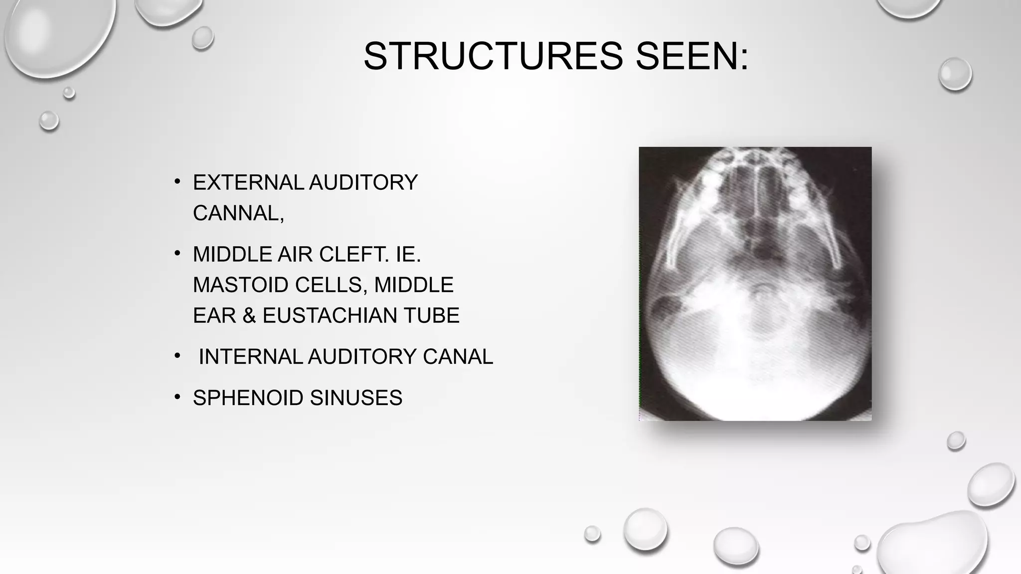 Radiological Imaging in Head and Neck and relevant anatomy | PPT
