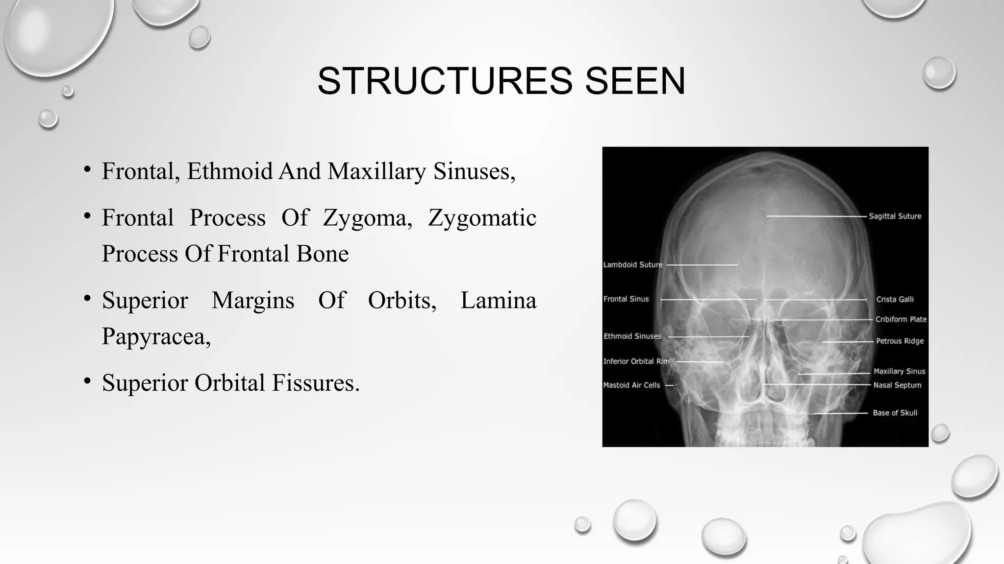 Radiological Imaging in Head and Neck and relevant anatomy | PPT
