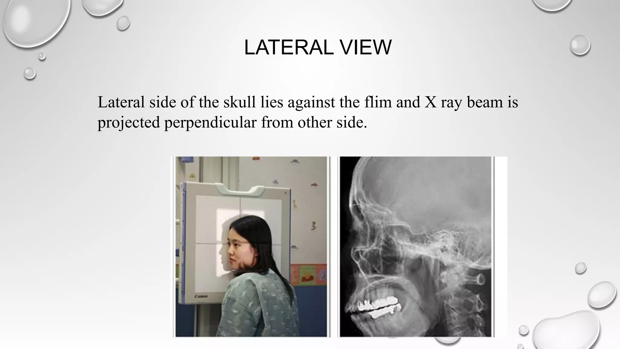 Radiological Imaging in Head and Neck and relevant anatomy | PPT