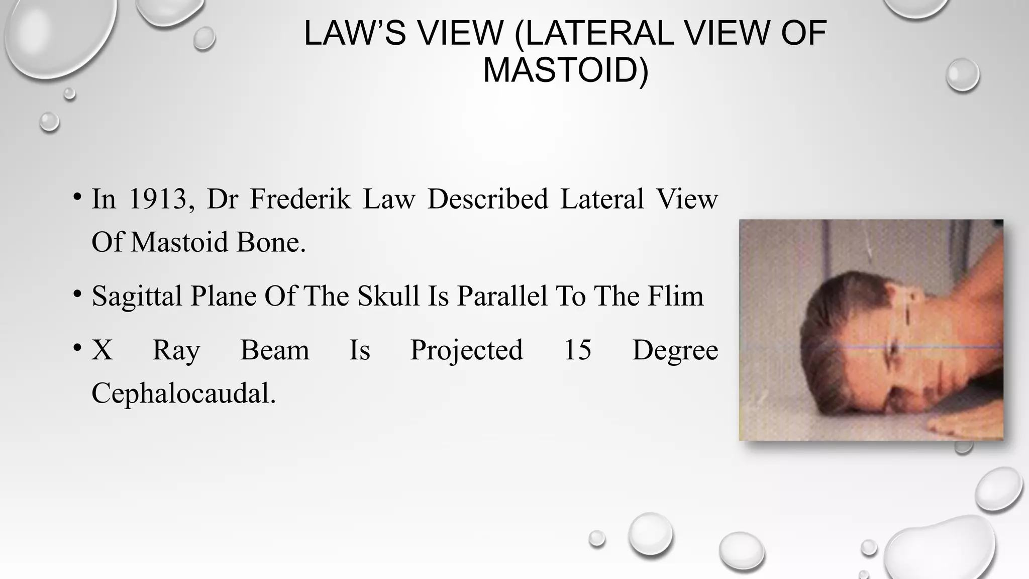 Radiological Imaging in Head and Neck and relevant anatomy | PPT