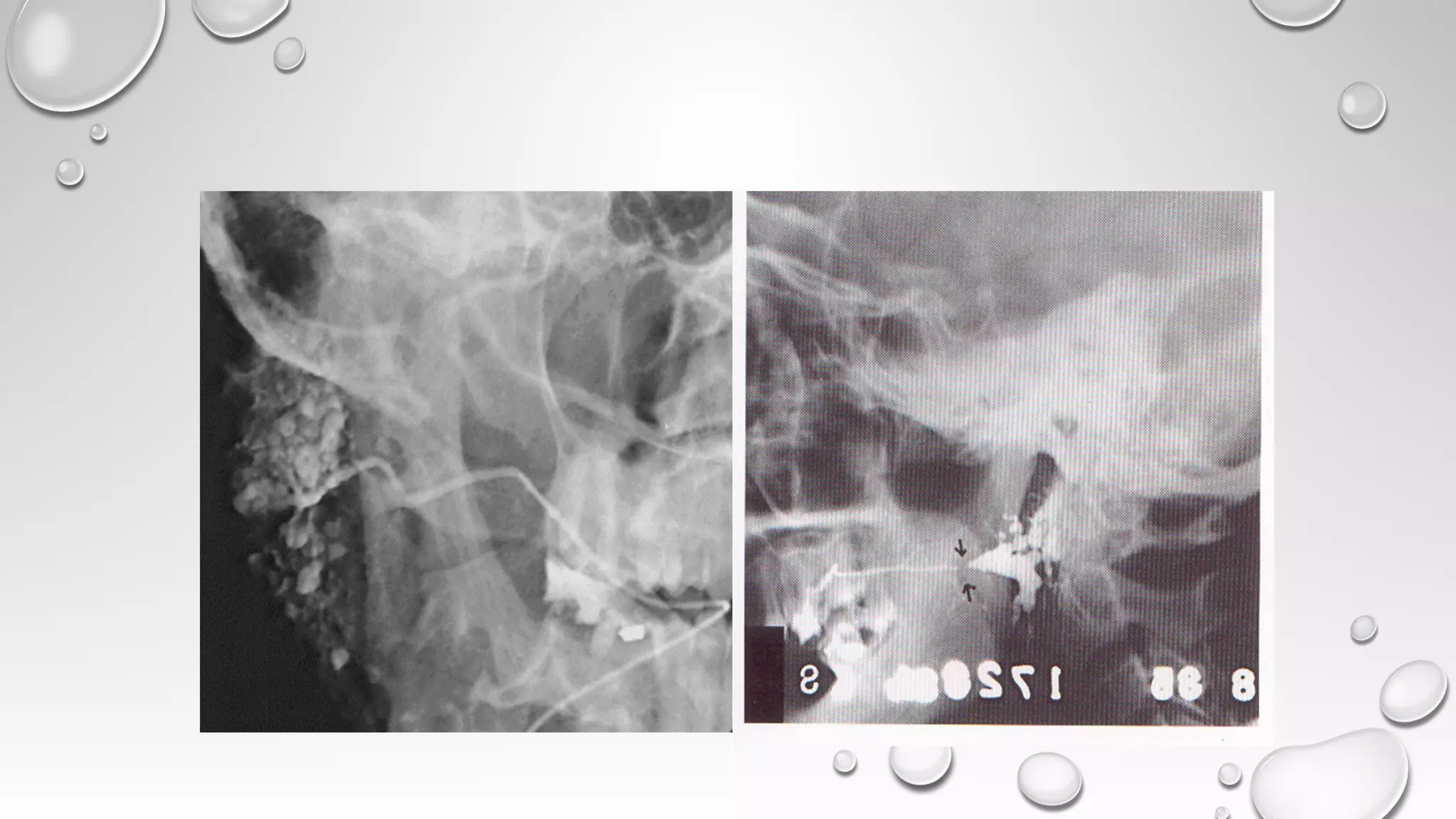 Radiological Imaging in Head and Neck and relevant anatomy | PPT