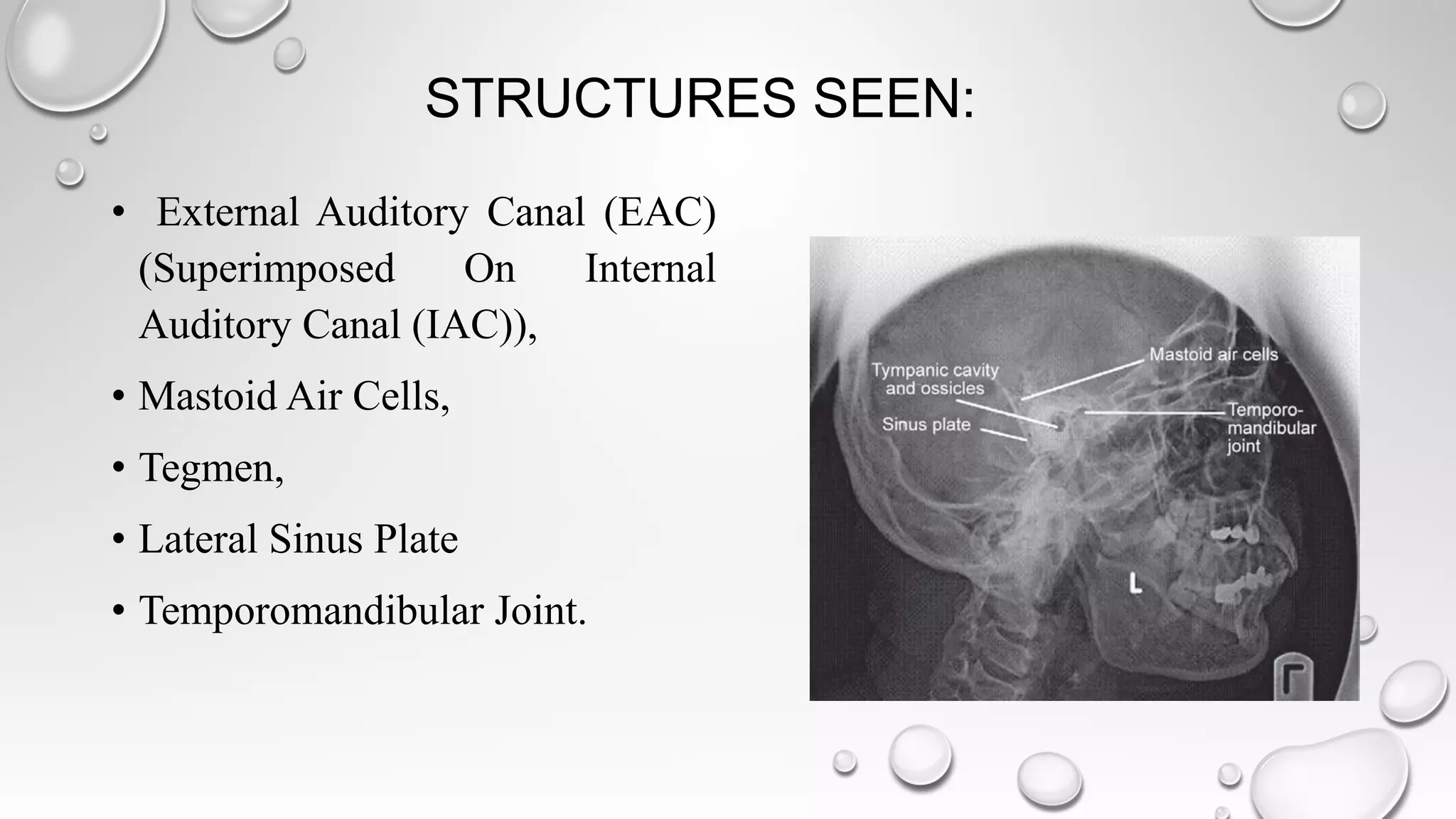 Radiological Imaging in Head and Neck and relevant anatomy | PPT