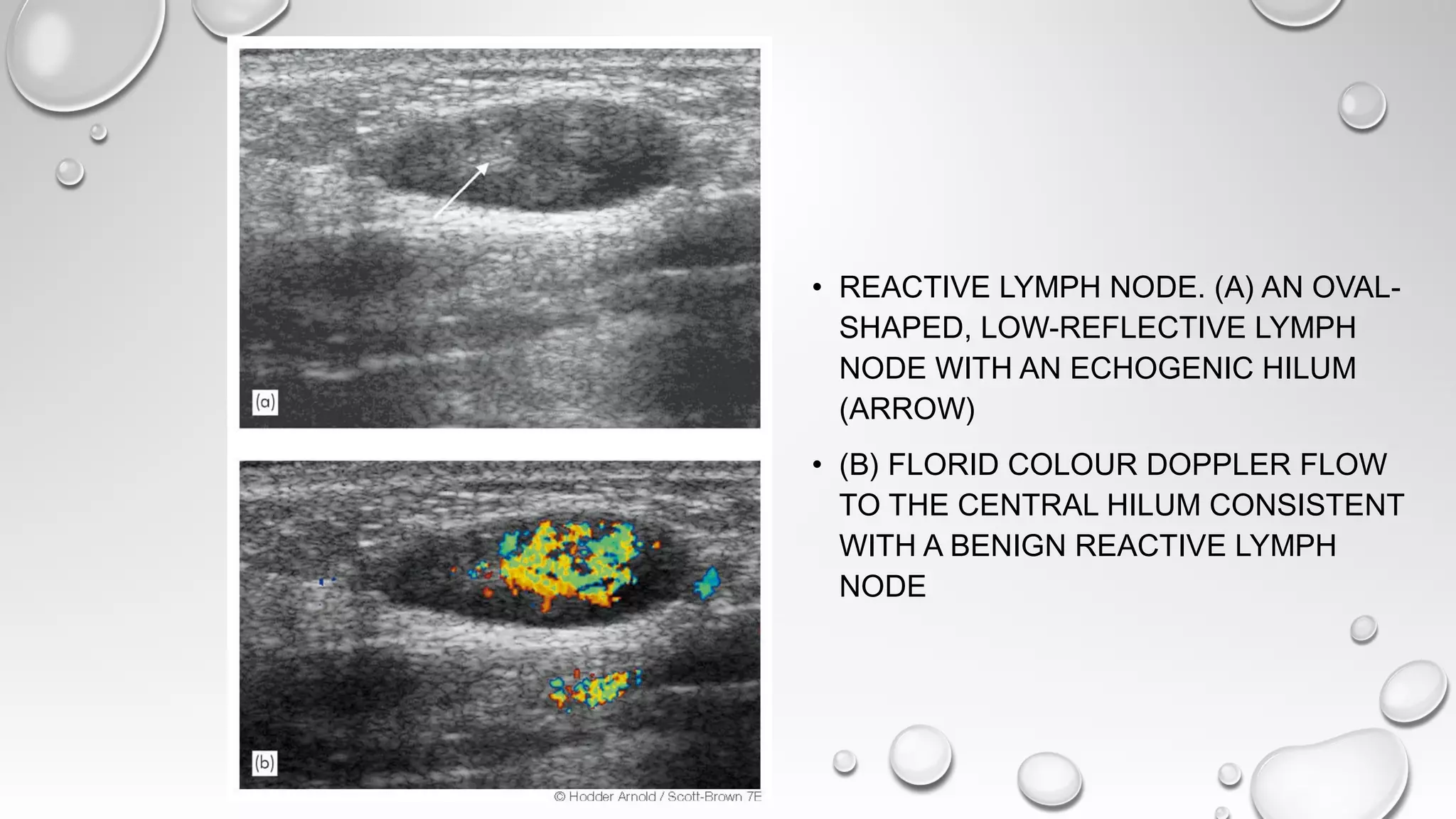 Radiological Imaging in Head and Neck and relevant anatomy | PPT