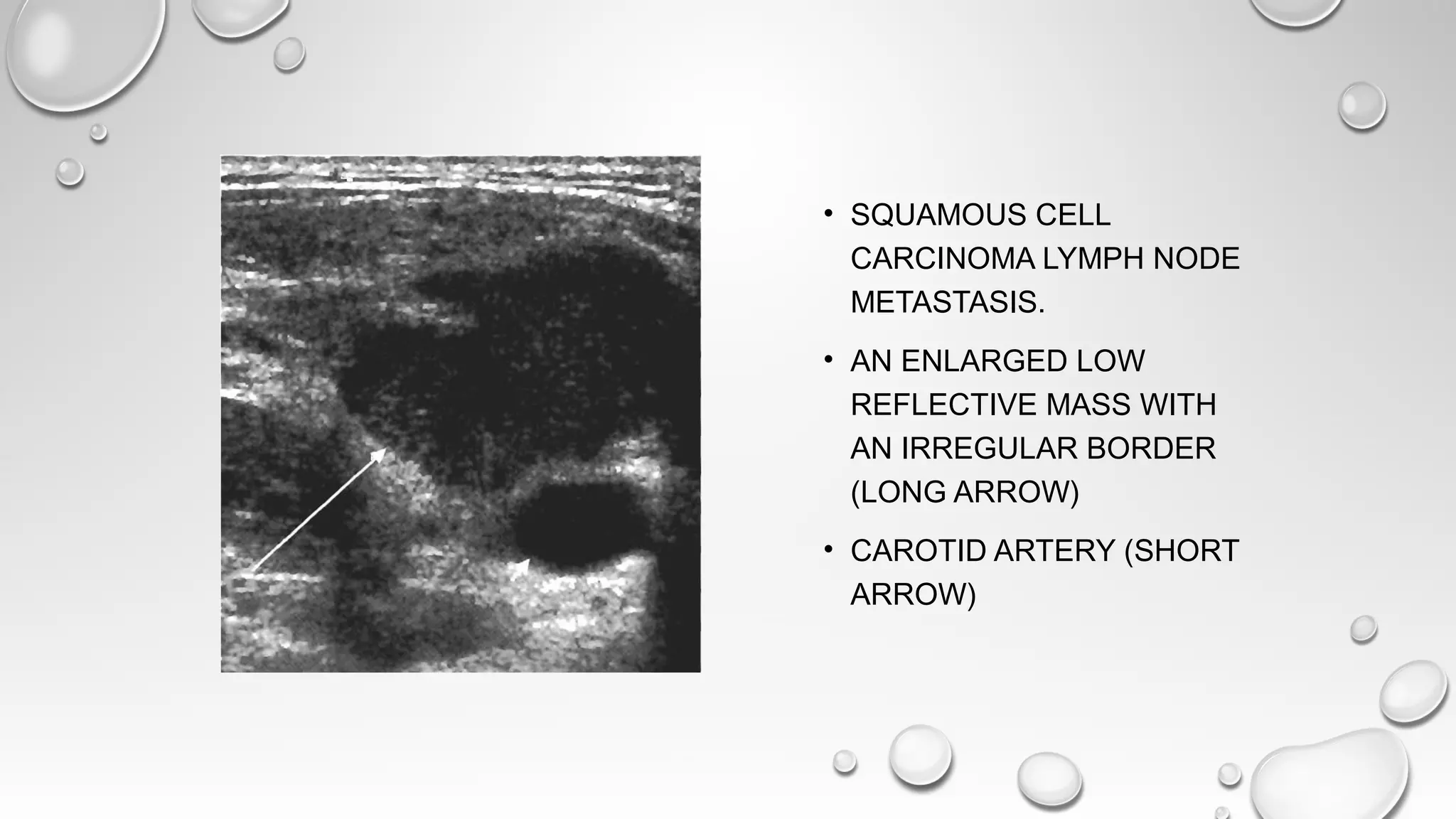 Radiological Imaging in Head and Neck and relevant anatomy | PPT